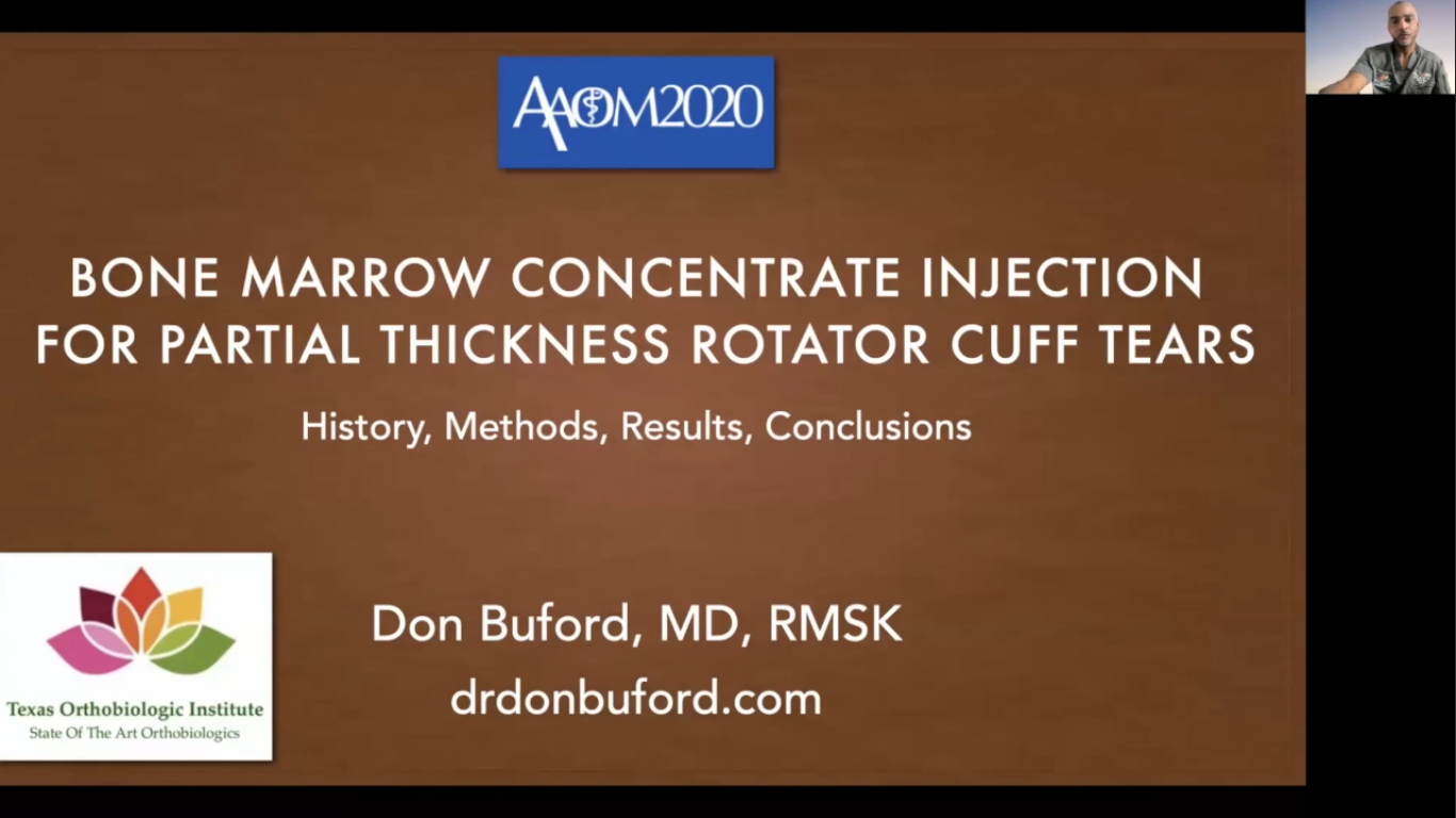 BMC Injections for Partial Thickness Rotator Cuff Tears | Doc Social